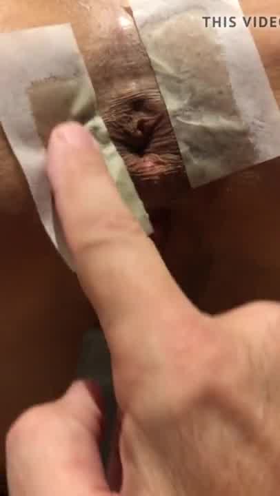 Epilation Anus Free Henti Gonzo Hd Porno Vid Hotntubes Com